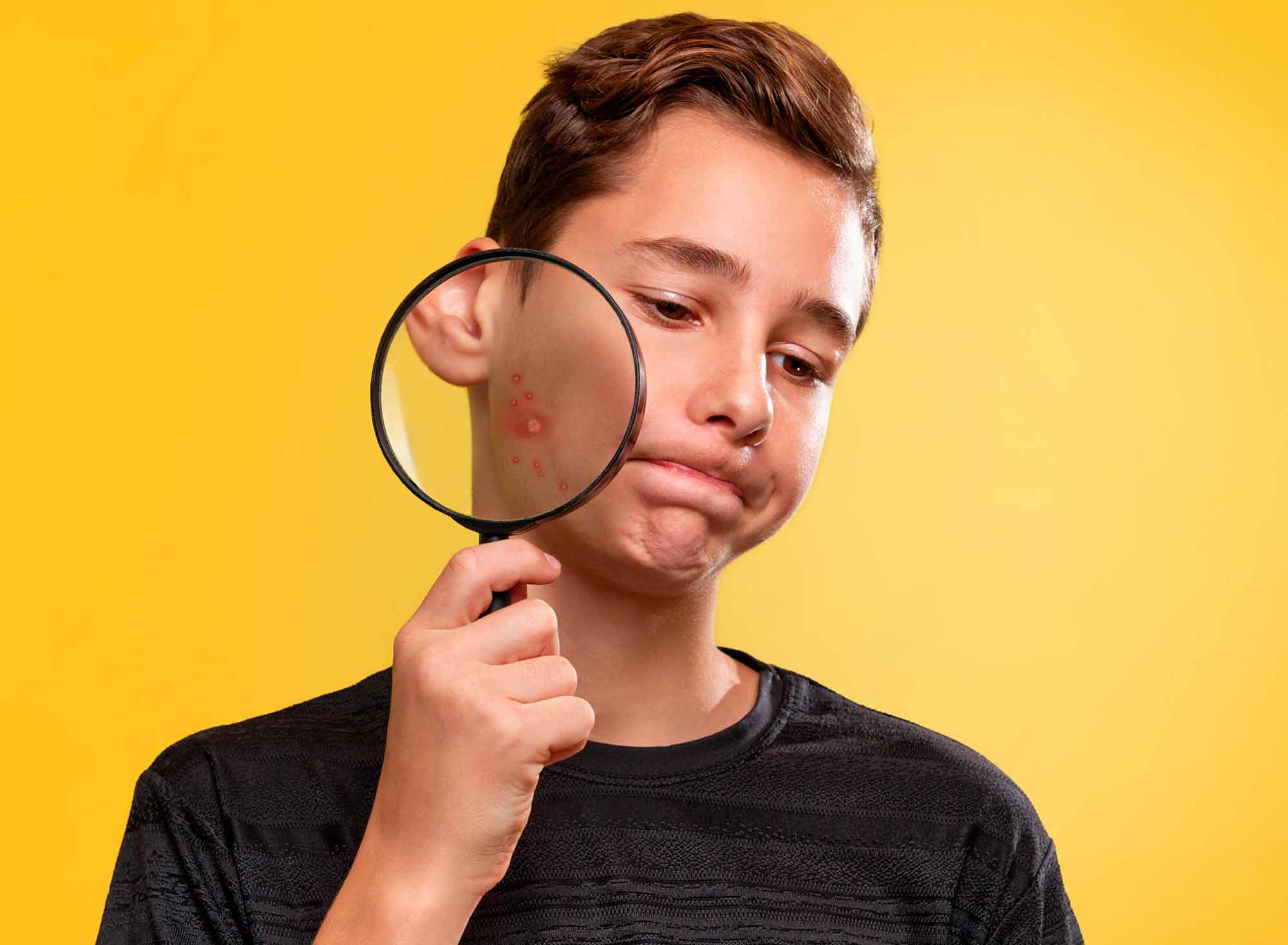 Pubertad en los varones, ¿qué cambios sufren?| Fundación BEST